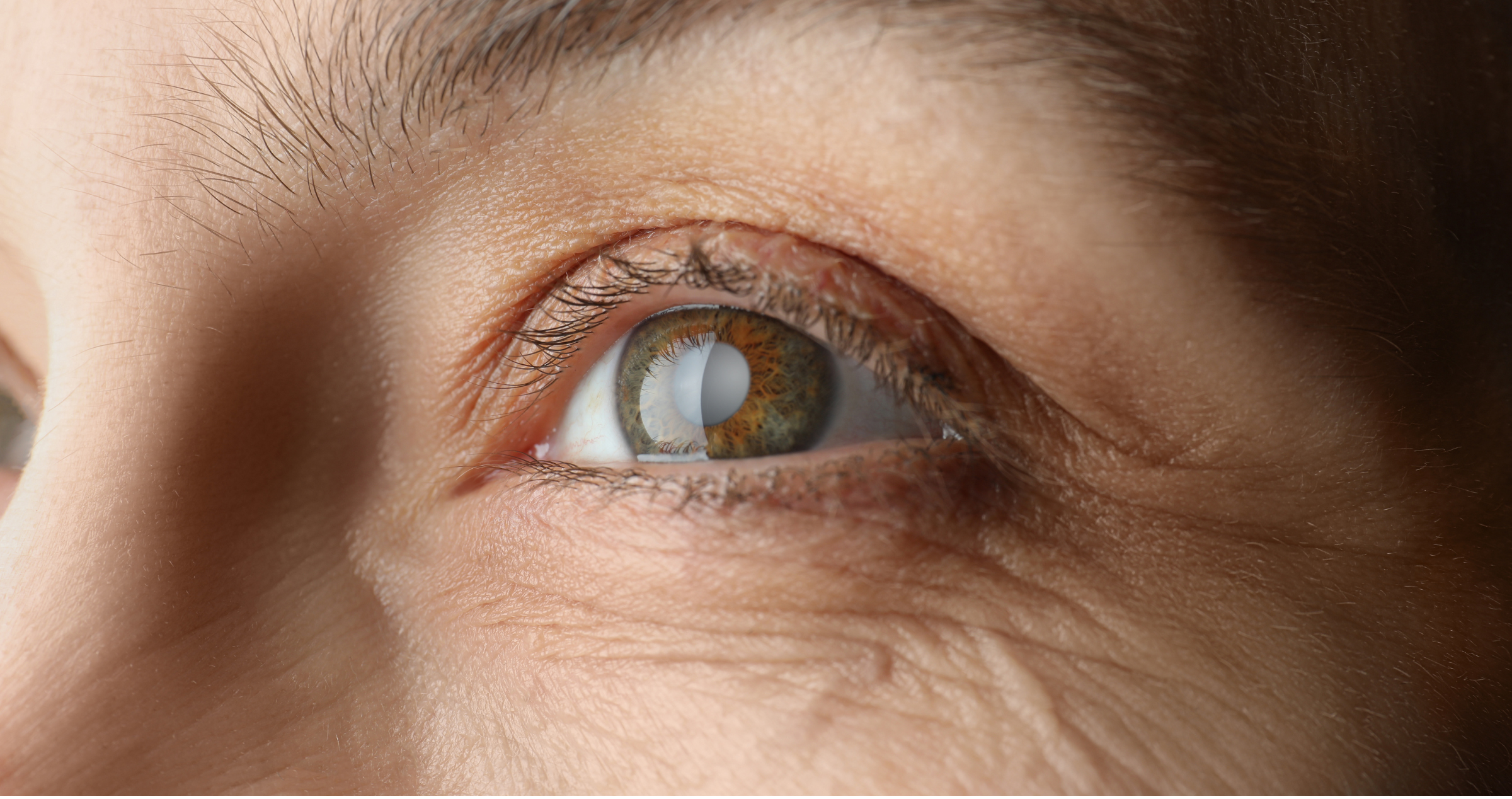 Understanding Different Types of Glaucoma | Glaucoma Australia